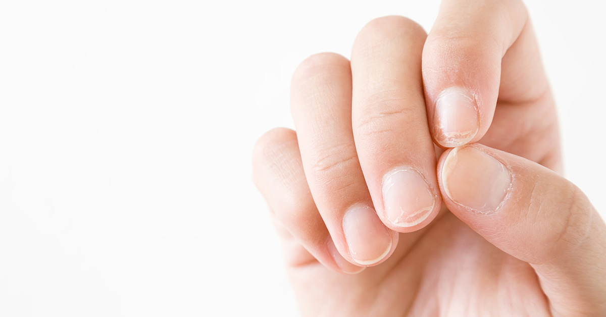Listanje noktiju na rukama - Zdravo budi