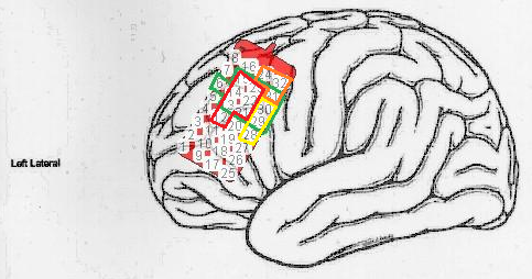 Što je glosofaringealna neuralgija? - Zdravo budi